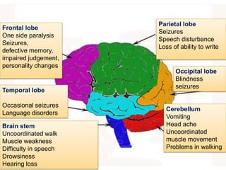 Brain tumor | PPSX