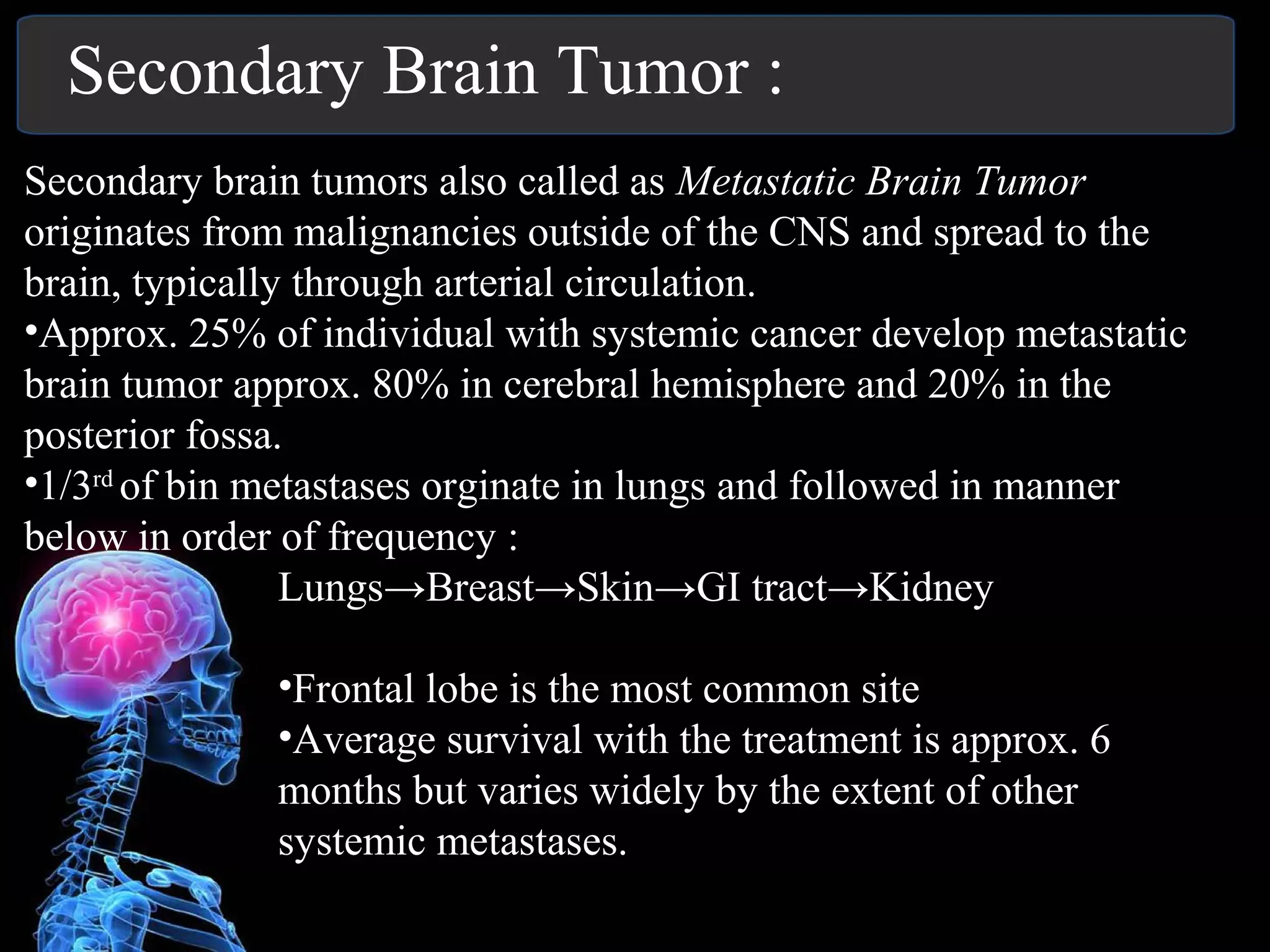 Brain tumor | PPT