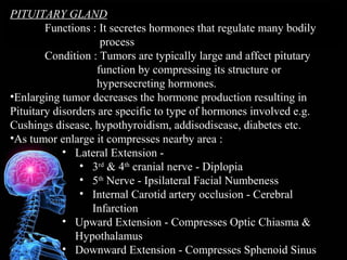 Brain tumor | PPT