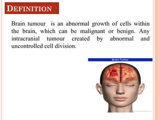 Brain tumor | PDF