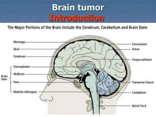 brain_tumor.ppt
