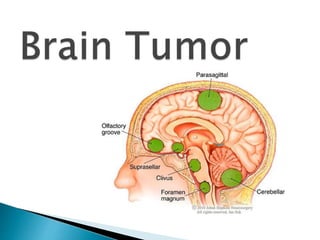 brain_tumor.pptx