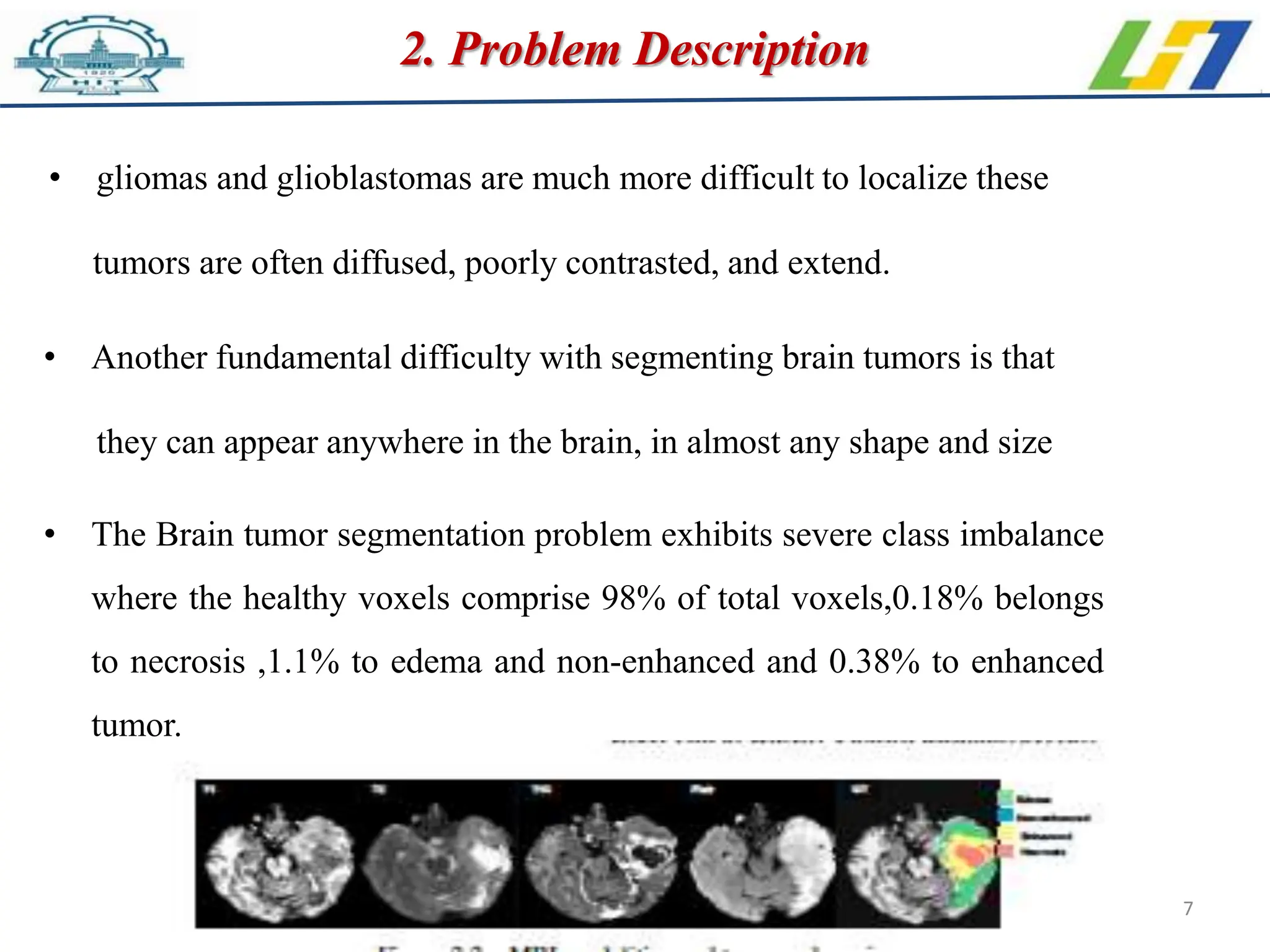 brain tumor.pptx