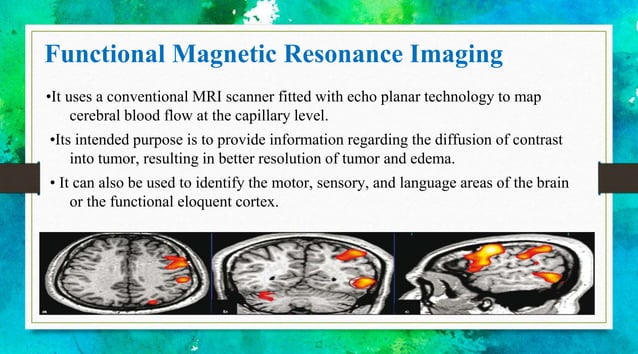Brain tumour (Central Nervous System Tumour).pptx