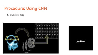 Brain Tumor Classification Using Deep Learning.pptx