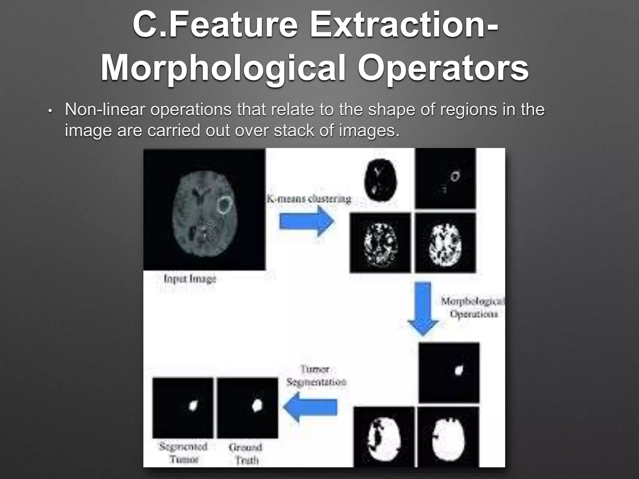 Brain tumor detection | PPTX