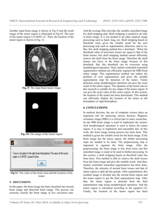 Brain tumor detection and segmentation using watershed segmentation and morphological operation ...