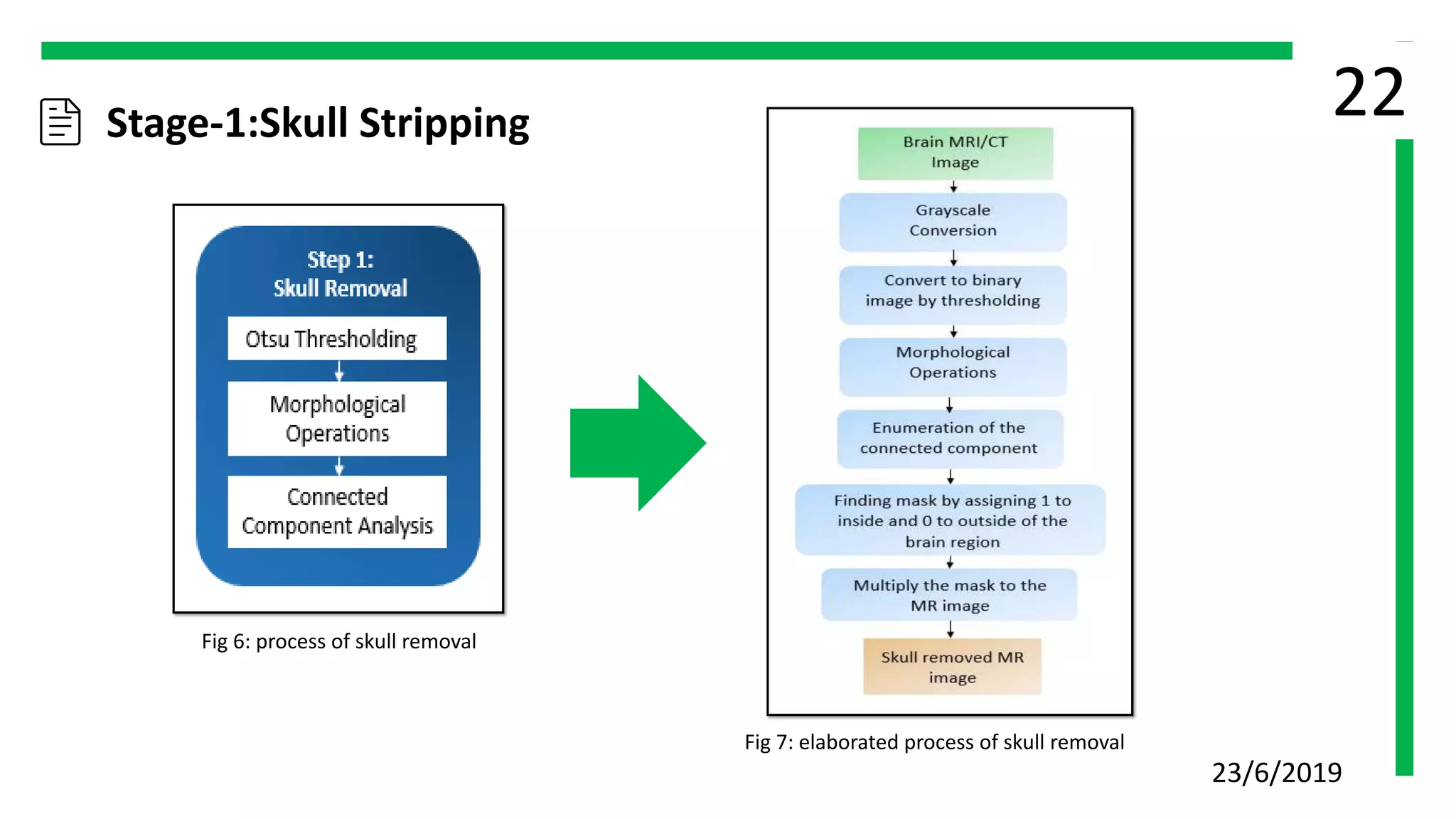 Brain Tumor Detection Using Convolutional Neural Network Pptx Brain