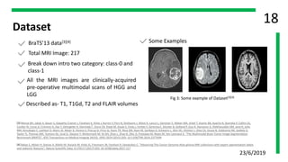 Brain tumor detection using convolutional neural network | PPTX