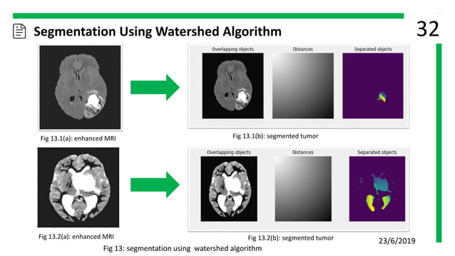 Brain tumor detection using convolutional neural network | PPTX | Brain ...