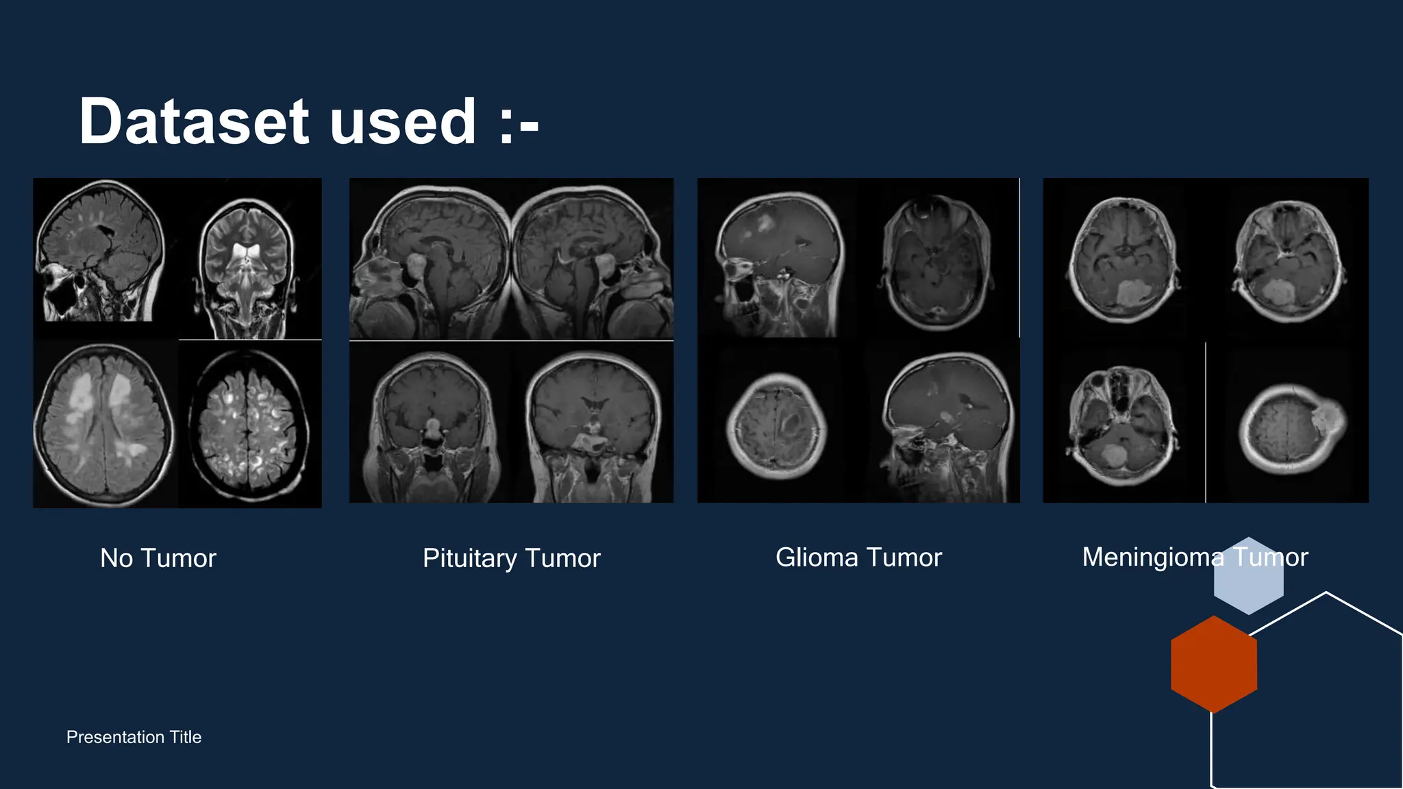 Brain Tumor Detection Using Deep Learning Ppt New Made Pptx