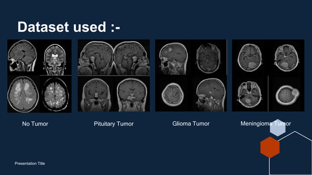 Brain Tumor Detection Using Deep Learning ppt new made.pptx