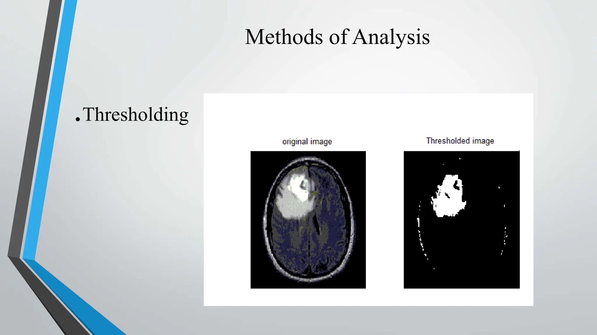 Brain Tumor Detection With Machine Learning Pptx Brain And Nervous