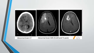 Brain Tumor Detection with Machine Learning.pptx