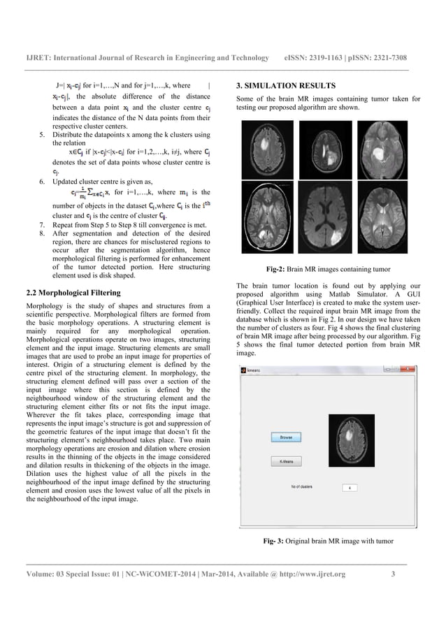 Brain tumor mri image segmentation and detection | PDF