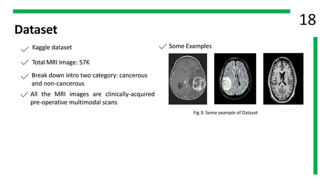 brain tumor ppt.pptx