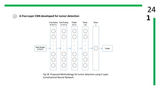 brain tumor ppt.pptx