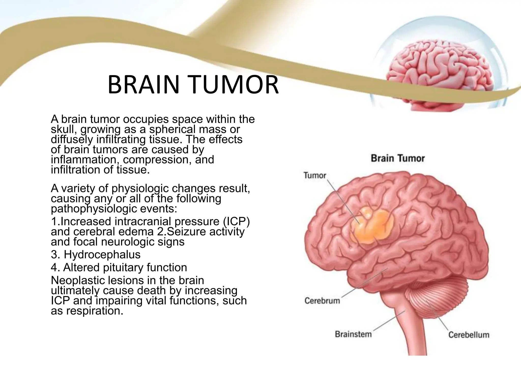 BRAIN TUMOR prepared by MS. Neha kewat.pptx