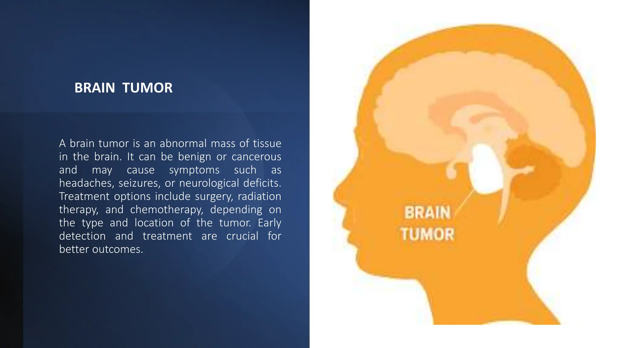 brain tumor presentation.pptxbraintumorpresentationonbraintumor | PPTX