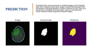 brain tumor presentation.pptxbraintumorpresentationonbraintumor | PPTX