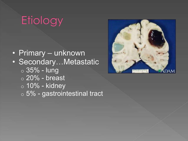 Brain Tumors.ppt