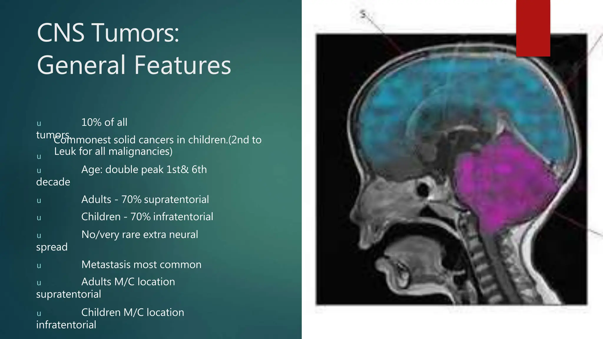 brain tumors-.power point brain diseases | PPTX