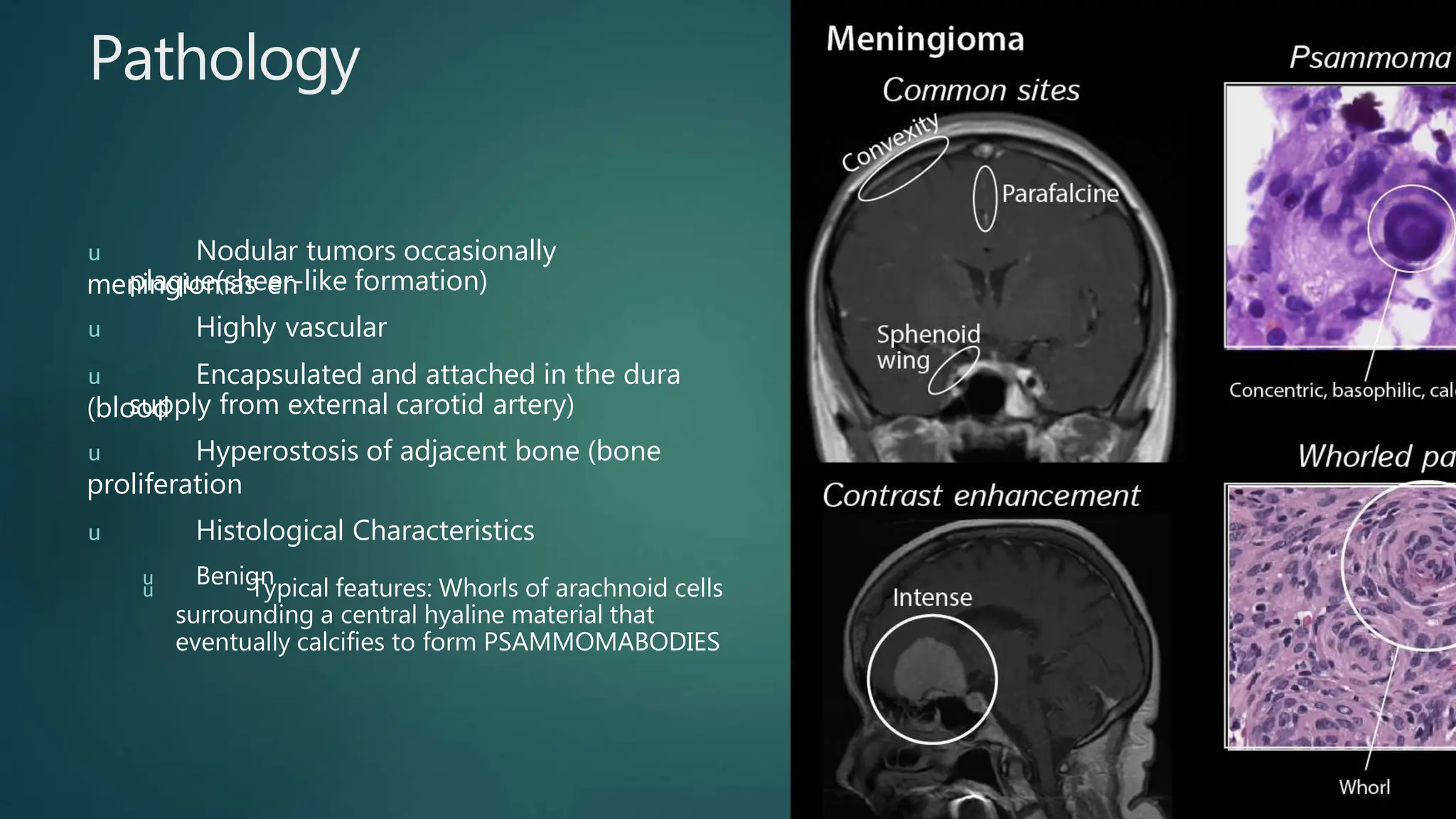 brain tumors-.power point brain diseases | PPTX