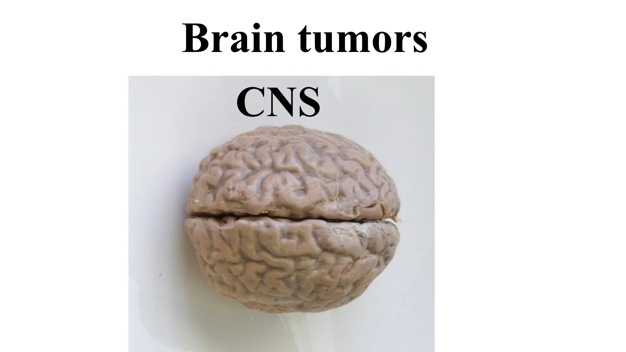 Brain tumors pathology Degenerative and demyelinating .pptx