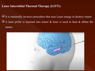 Brain Tumors .pptx | Cancer | Diseases and Conditions