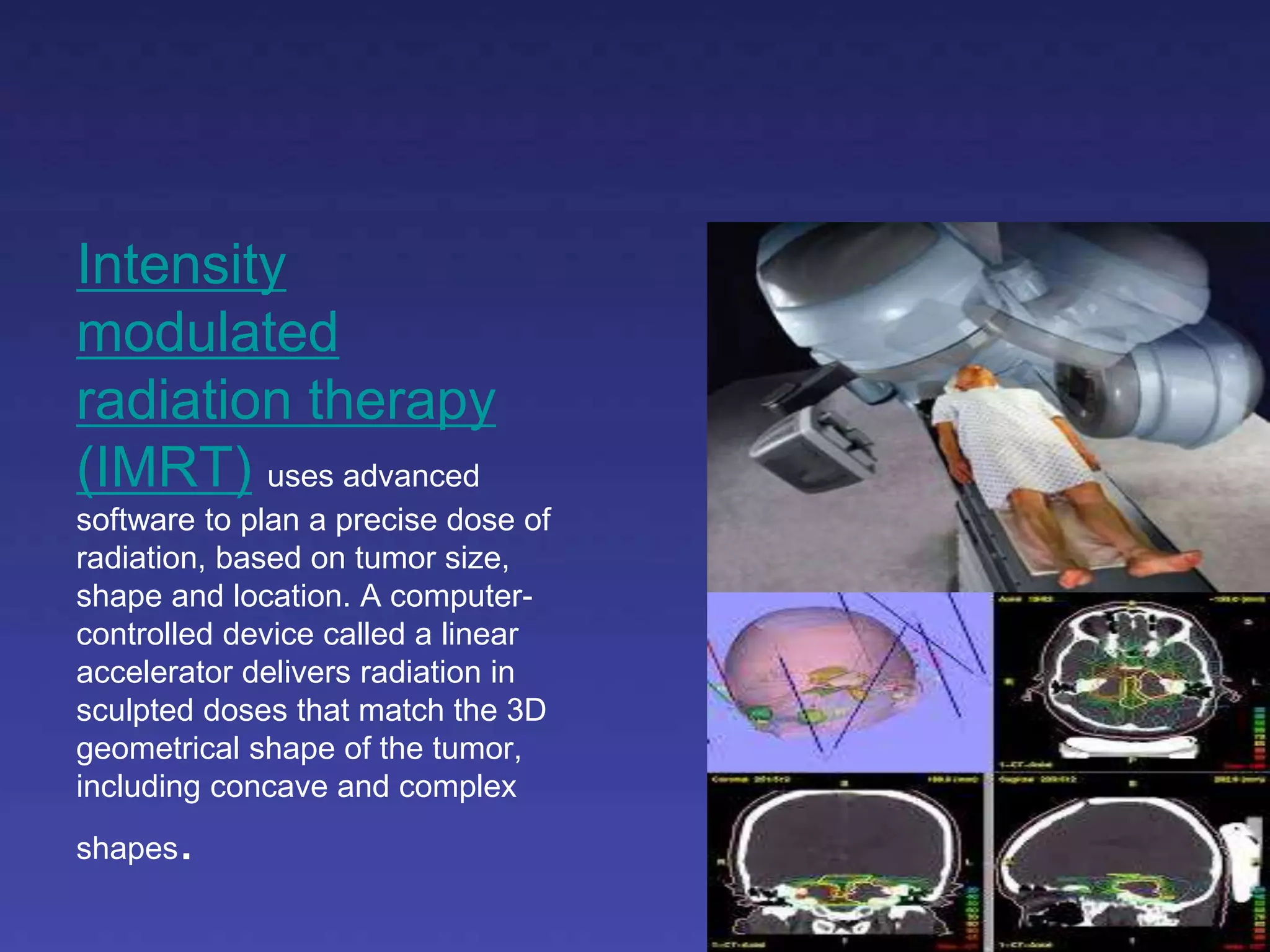 Brain tumors Radio diagnosis and therapy | PPTX