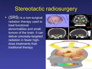 Brain tumors Radio diagnosis and therapy | PPTX
