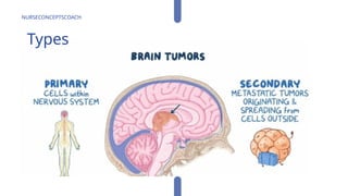 Brain tumors- types, causes , treatment ppt | PPT