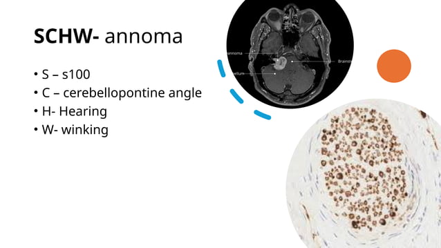 Primary brain tumors and their brief explanation | PPT
