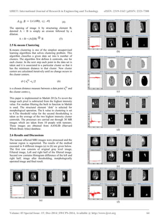 Brain tumor segmentation using asymmetry based histogram thresholding and k means clustering ...