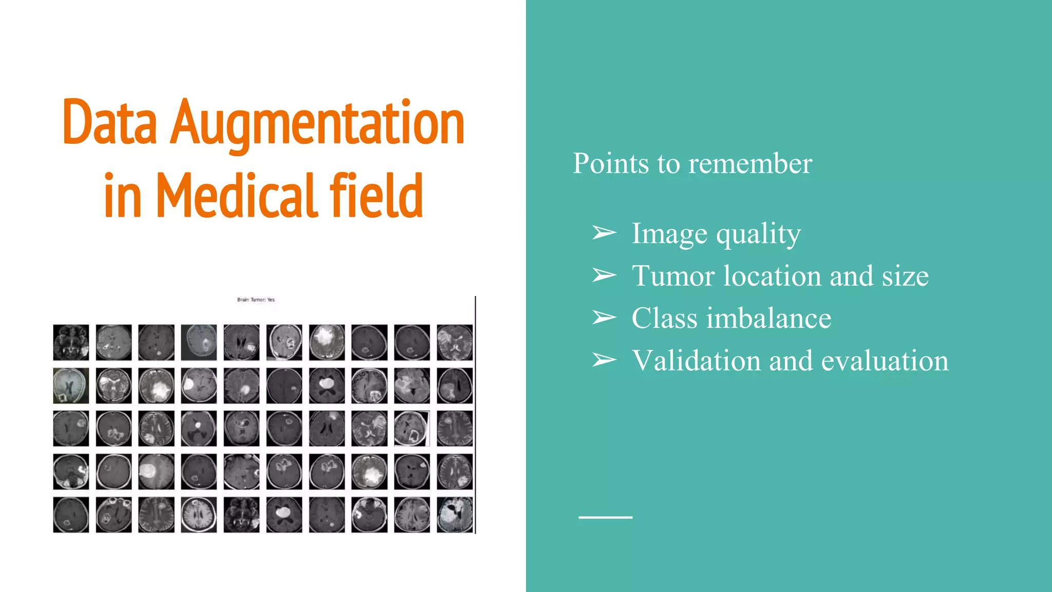 Brain Tumour Detection Pptx