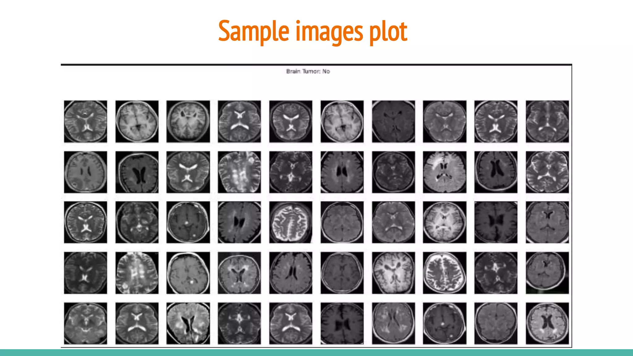 Brain Tumour Detection Pptx