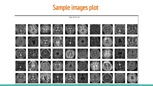 Brain Tumour Detection.pptx