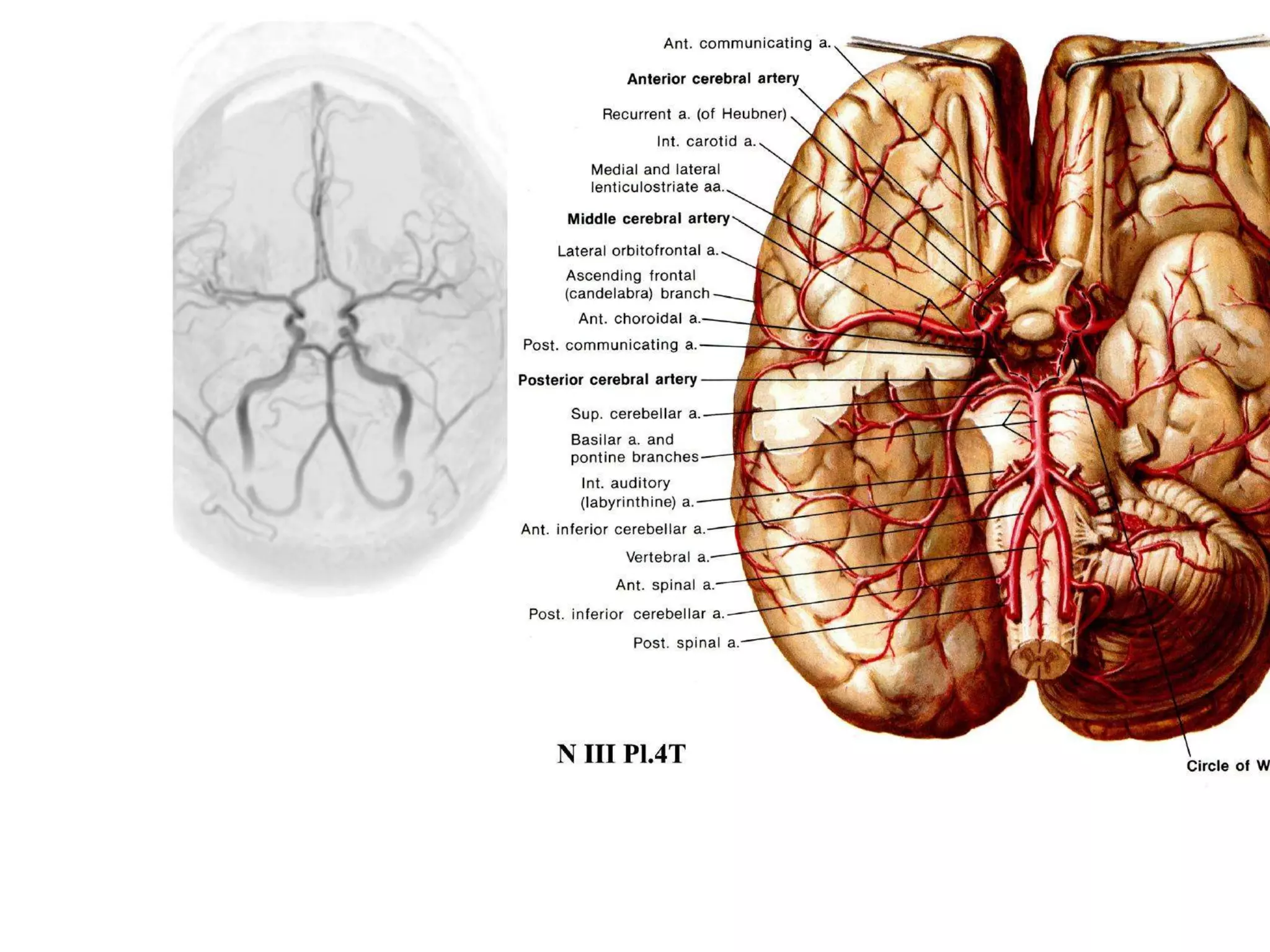 Brain vascular anatomy with MRA and MRI correlation | PPTX