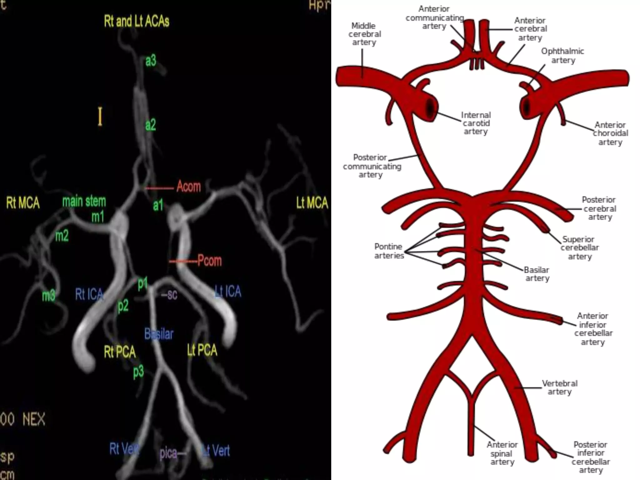 Brain vascular anatomy with MRA and MRI correlation | PPTX