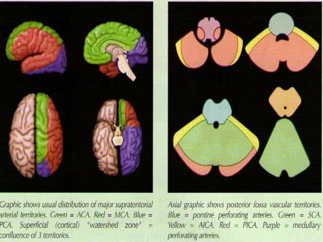 Brain vascular anatomy with MRA and MRI correlation | PPTX