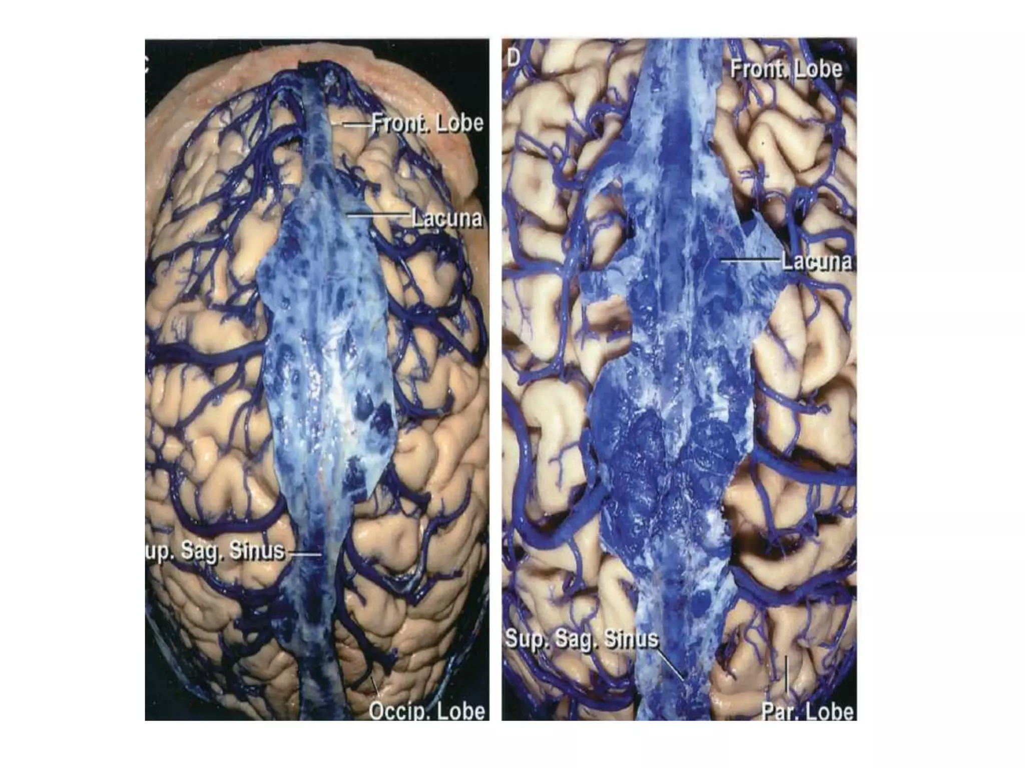Brain venous system | PPTX