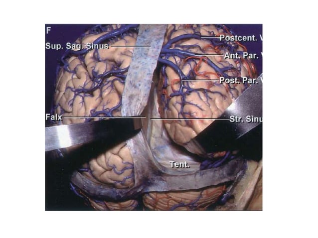 Brain venous system | PPT