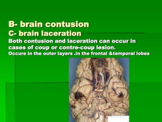 Brain ,vert.,neck,chest&abdominal inj. | PPTX