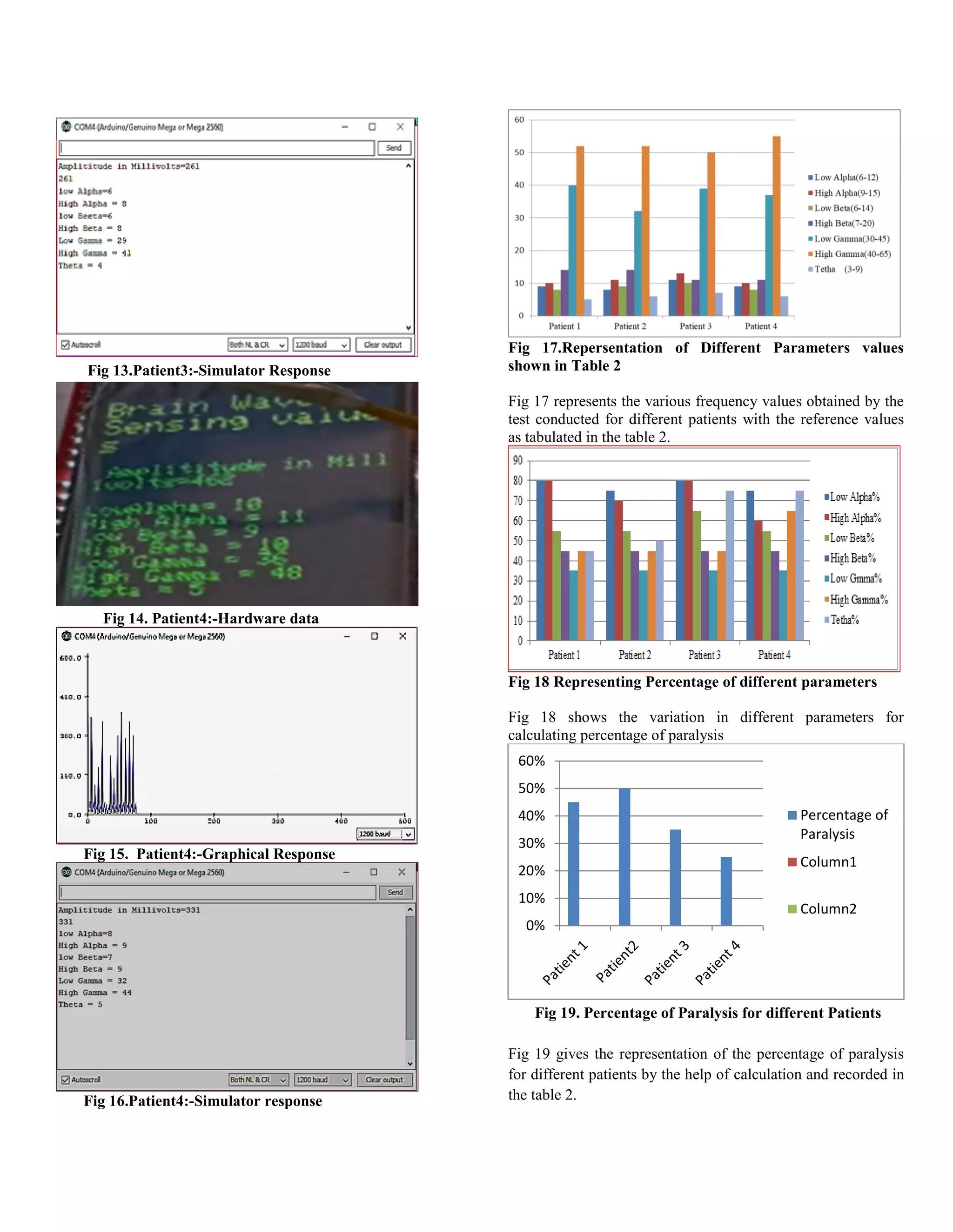Smart Brain Wave Sensor for Paralyzed- A Real Time Implementation | PDF