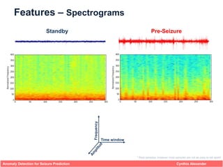 Anomaly Detection for Seizure Prediction | PPT