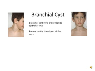Branchial Remnants and Branchial Cyst | PPT