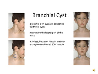Branchial Remnants and Branchial Cyst | PPT