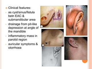Branchial anomalies | PPTX