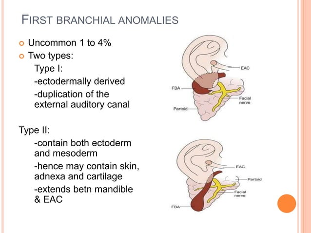 Branchial anomalies