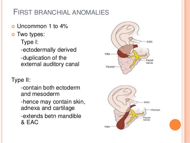 Branchial anomalies